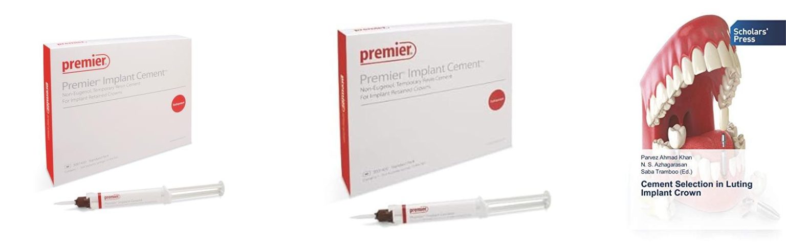 Top 5 Cement for Implant Crowns: A Buyer's Guide