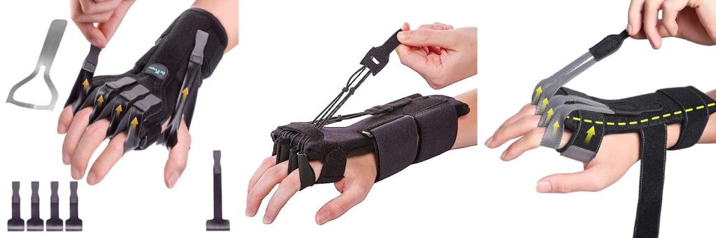 Top 5 Splints for Radial Nerve Palsy: Your Guide