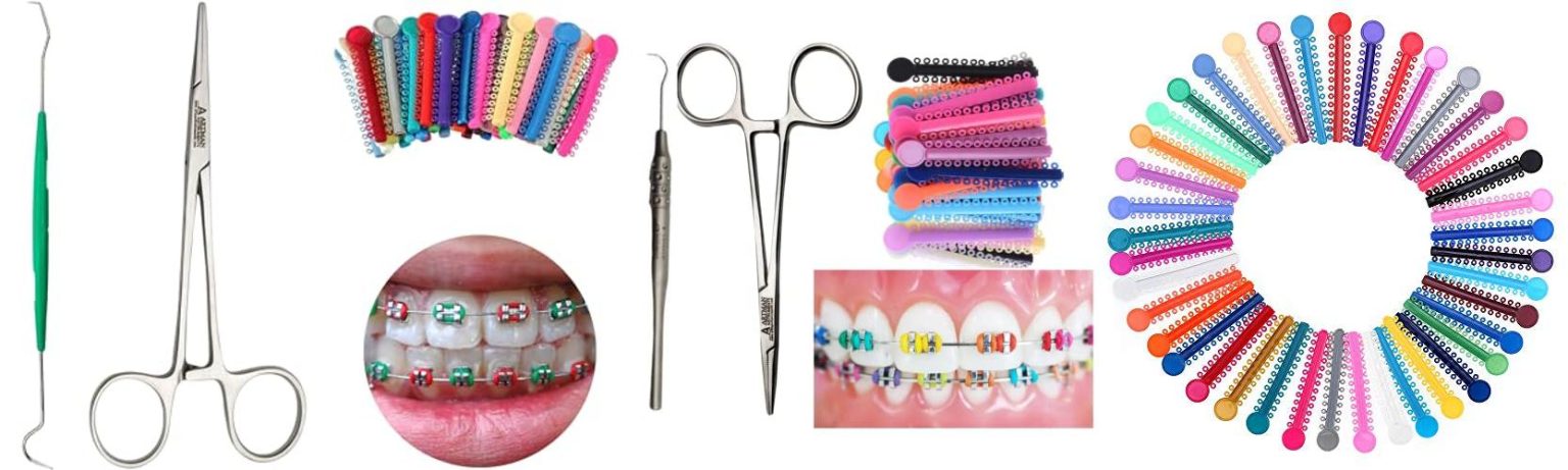 Top 5 Summer Braces Colors: Your Perfect Guide
